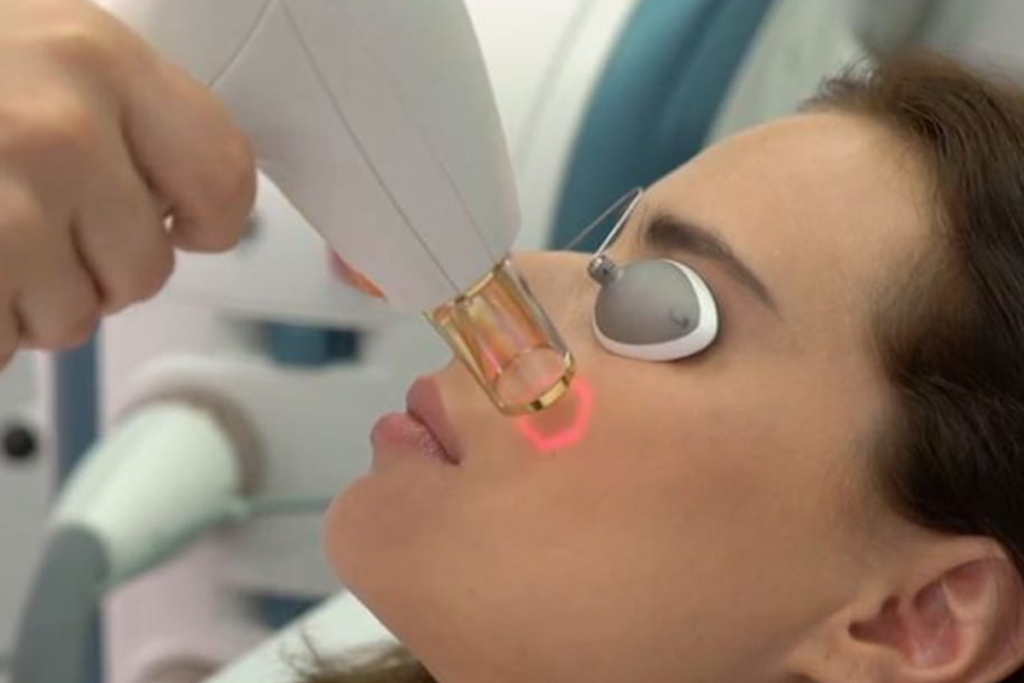 Moxi Laser in Beverly Hills, CA | Beverly Hills Sculptress